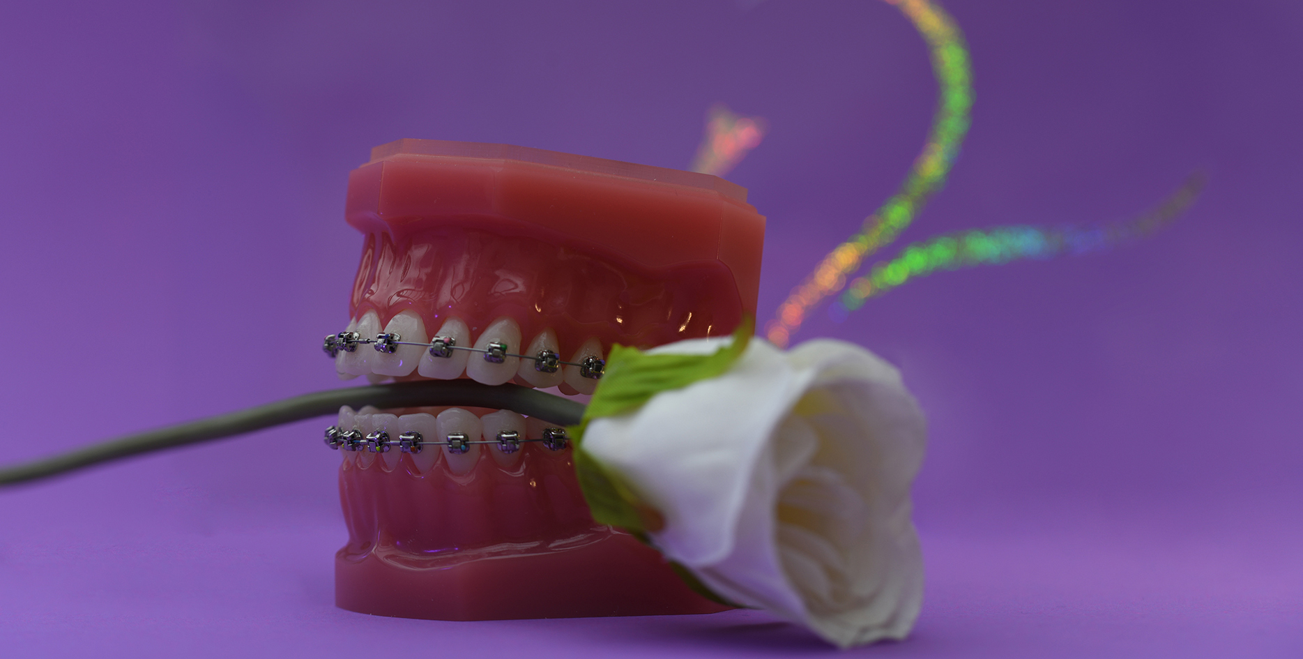 Vaste Beugel | Ortho Denti